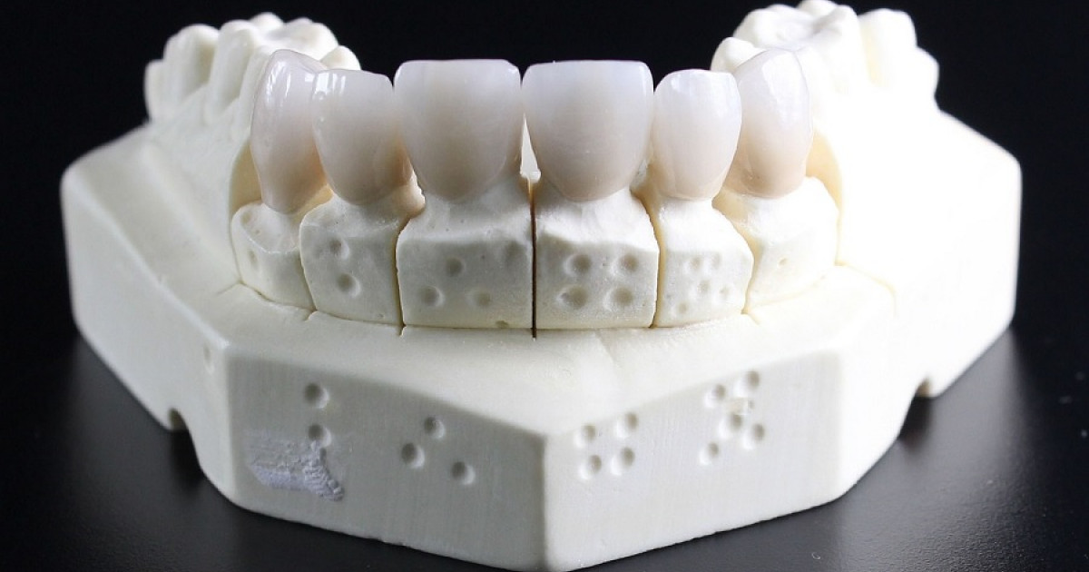 Biomaterials: What They Are, Types and Characteristics | Psychology | 2022