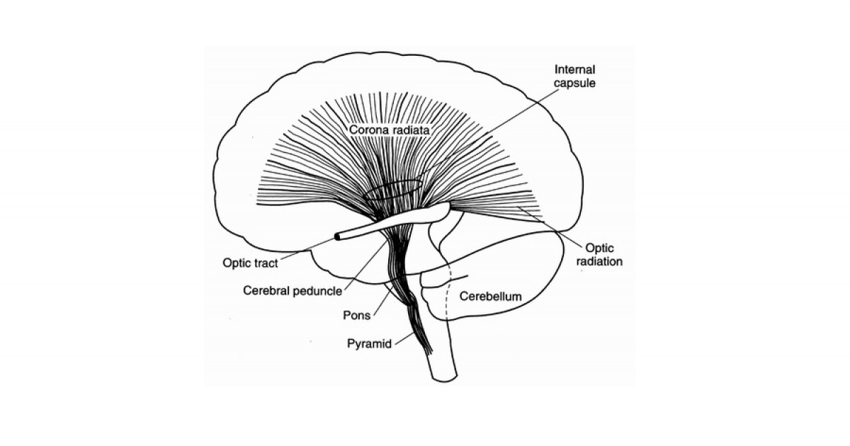 Corona Radiata: Characteristics and Functions of This Part of the Brain ...