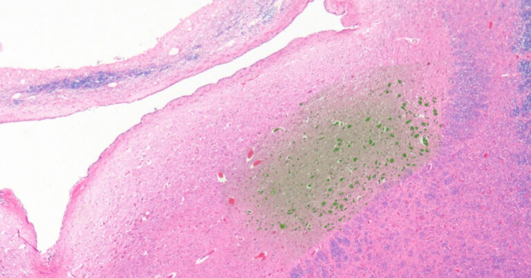 Locus Coeruleus: Its Anatomy, Functions and Diseases | Psychology | 2023