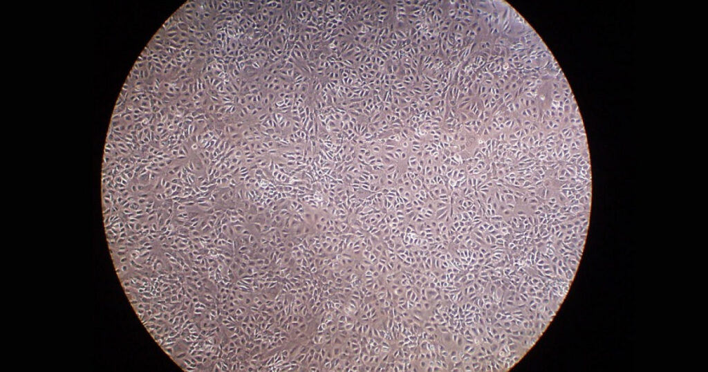 Mesothelium: What it Is, Characteristics and Associated Diseases ...