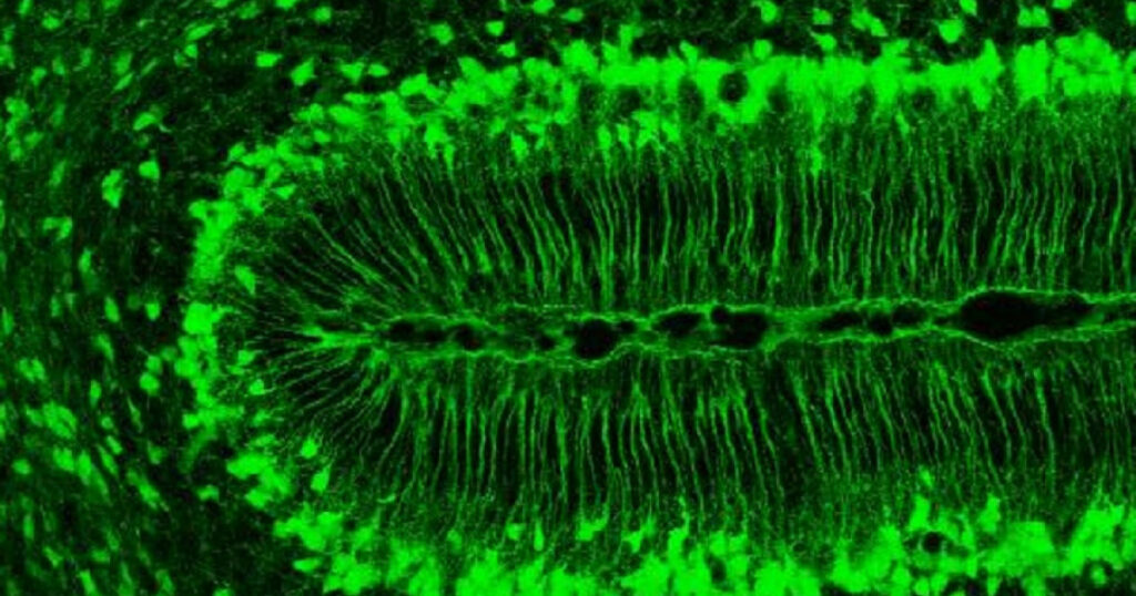 Radial Glia: What is it and What Functions Does it Have in the Brain ...