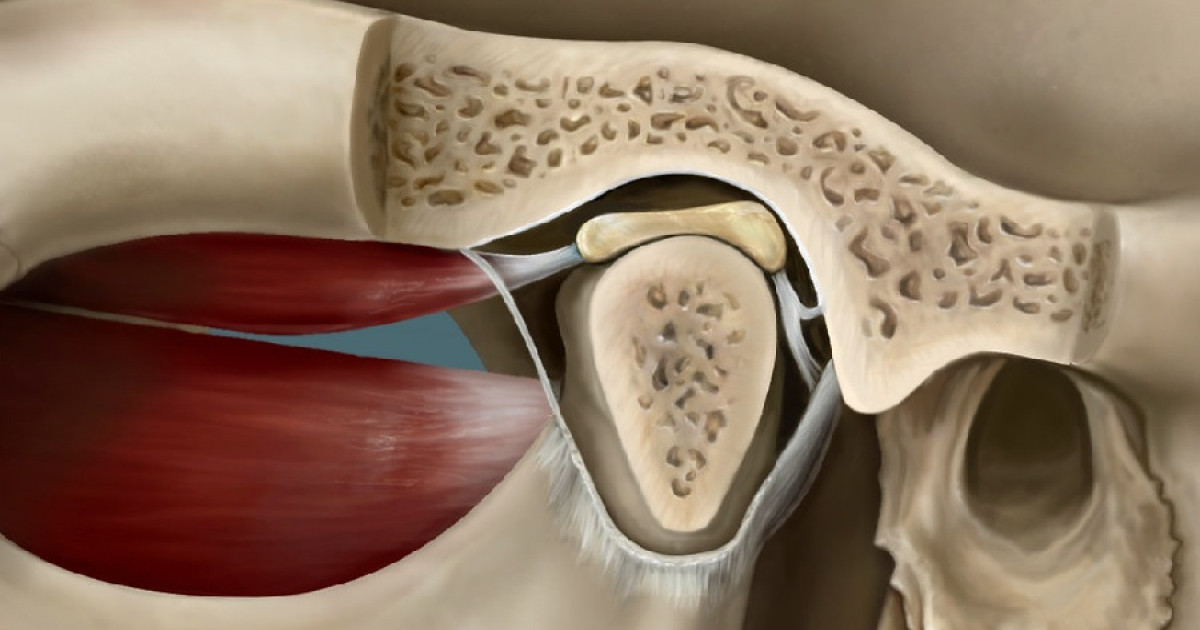 Temporomandibular Joint: Characteristics, Anatomy and Diseases ...