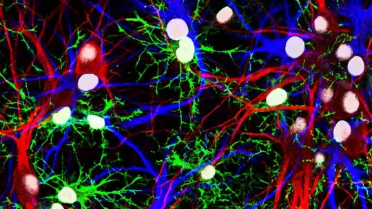 All or Nothing Law: What it is and Why it is Important in Neurology | 2026